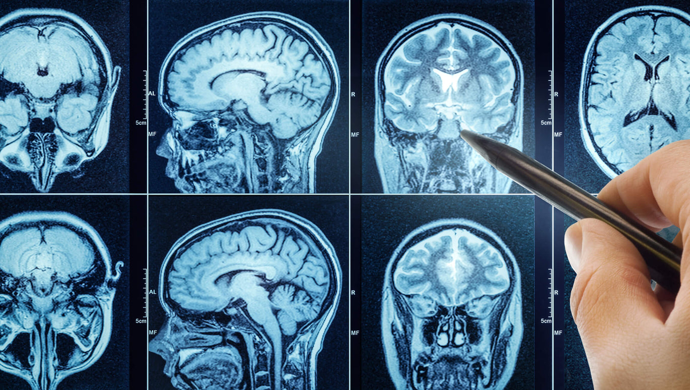 What 300,000 Brain Scans Have Taught Us About Mental Health – Amen ...